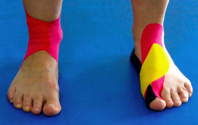 Kinesiologisches Taping - DuItNow - Gesundheit, Bewegung, Ernährung ...